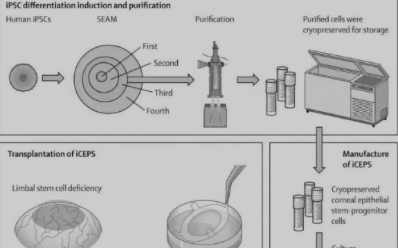 Human vision restored by stem cell replacement in regenerative medicine ...